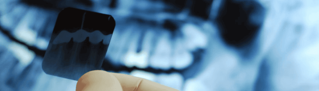 OrthoCAD Service in Houston | Advance Orthodontics