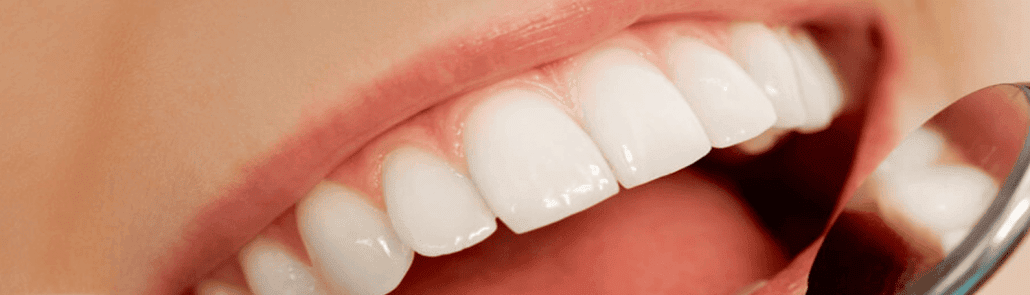 Temporary Anchorage Devices | Advance Orthodontics