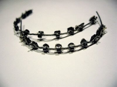 History of Braces | Advance Orthodontics Blog
